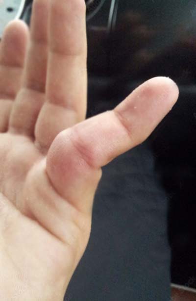 FM Orthopedics || Fracture Fixation